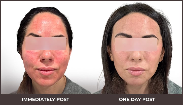 Chronos: The New Standard for Exosomes in Aesthetics