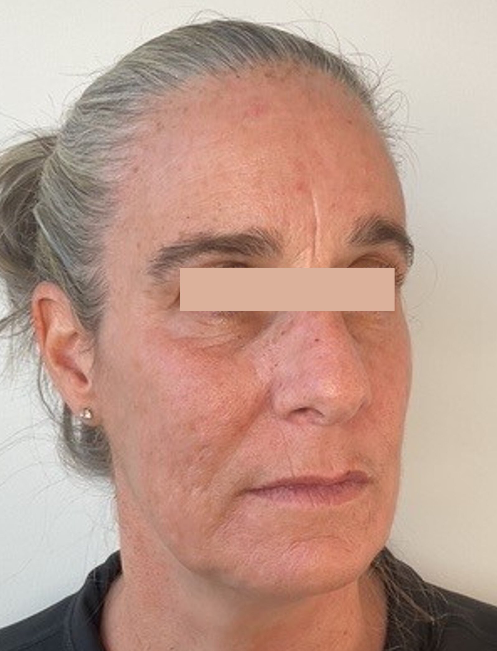 Prisma – A Full Spectrum Approach