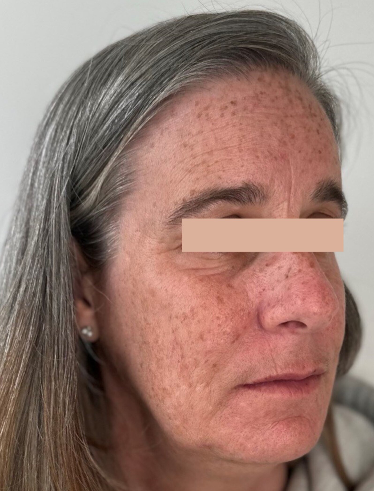 Prisma – A Full Spectrum Approach